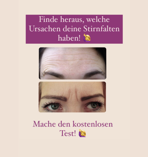 Falten auf der Stirn? Stirnfalten einfach glätten in drei Schritten